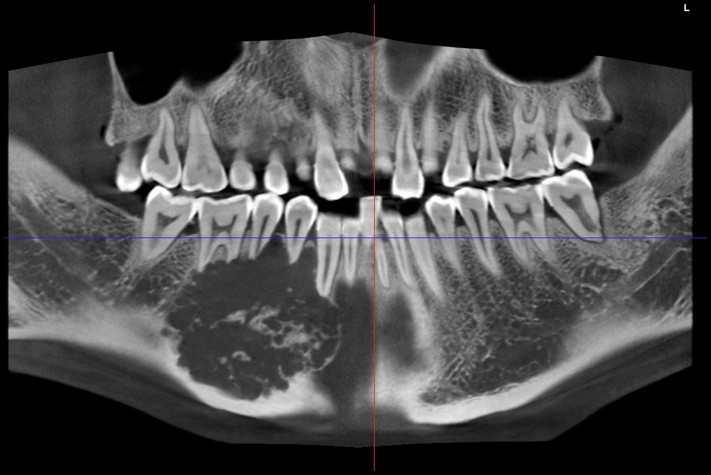 放射科-中南大学湘雅口腔医学院(湘雅口腔医院)